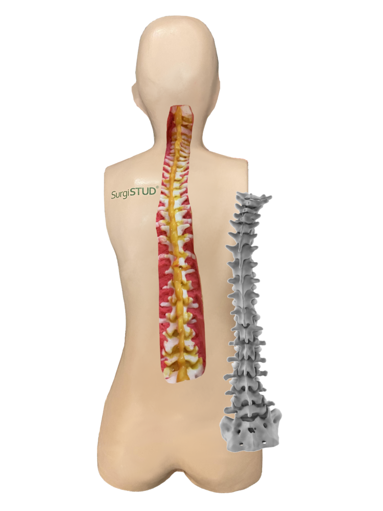 Adult Degenerative Spine – SurgiSTUD