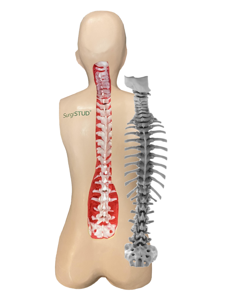 Adult Normal Occiput to Sacrum 1 – SurgiSTUD