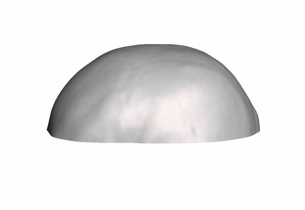 Calvarium – SurgiSTUD