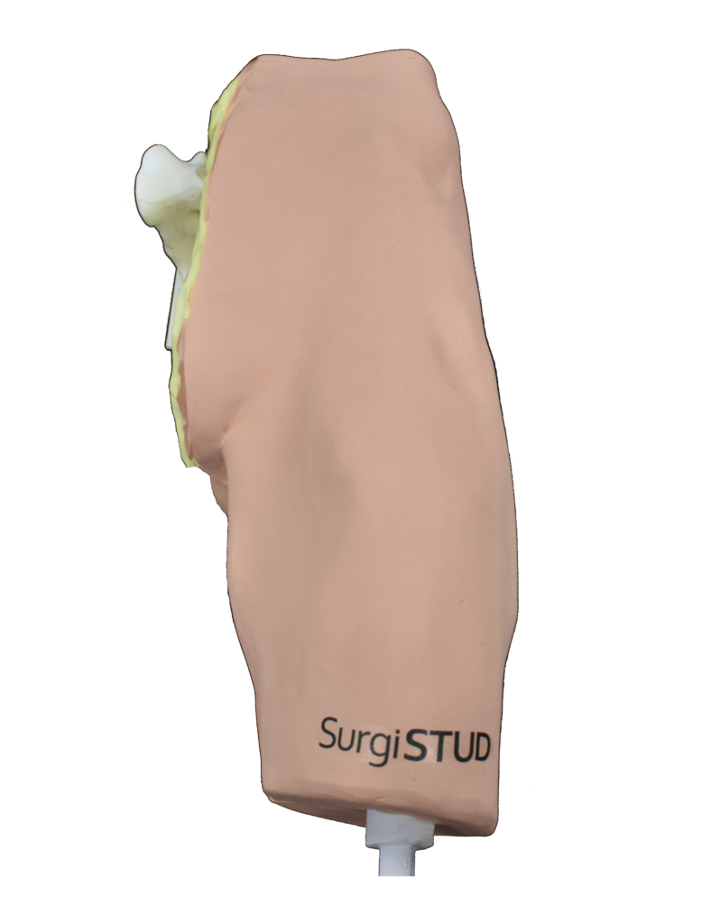 Stryker Comprehensive Hip – Casted – SurgiSTUD