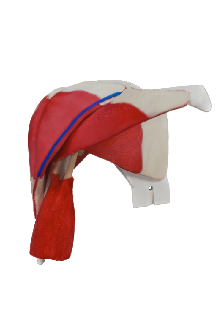 Comprehensive Shoulder – Casted – SurgiSTUD