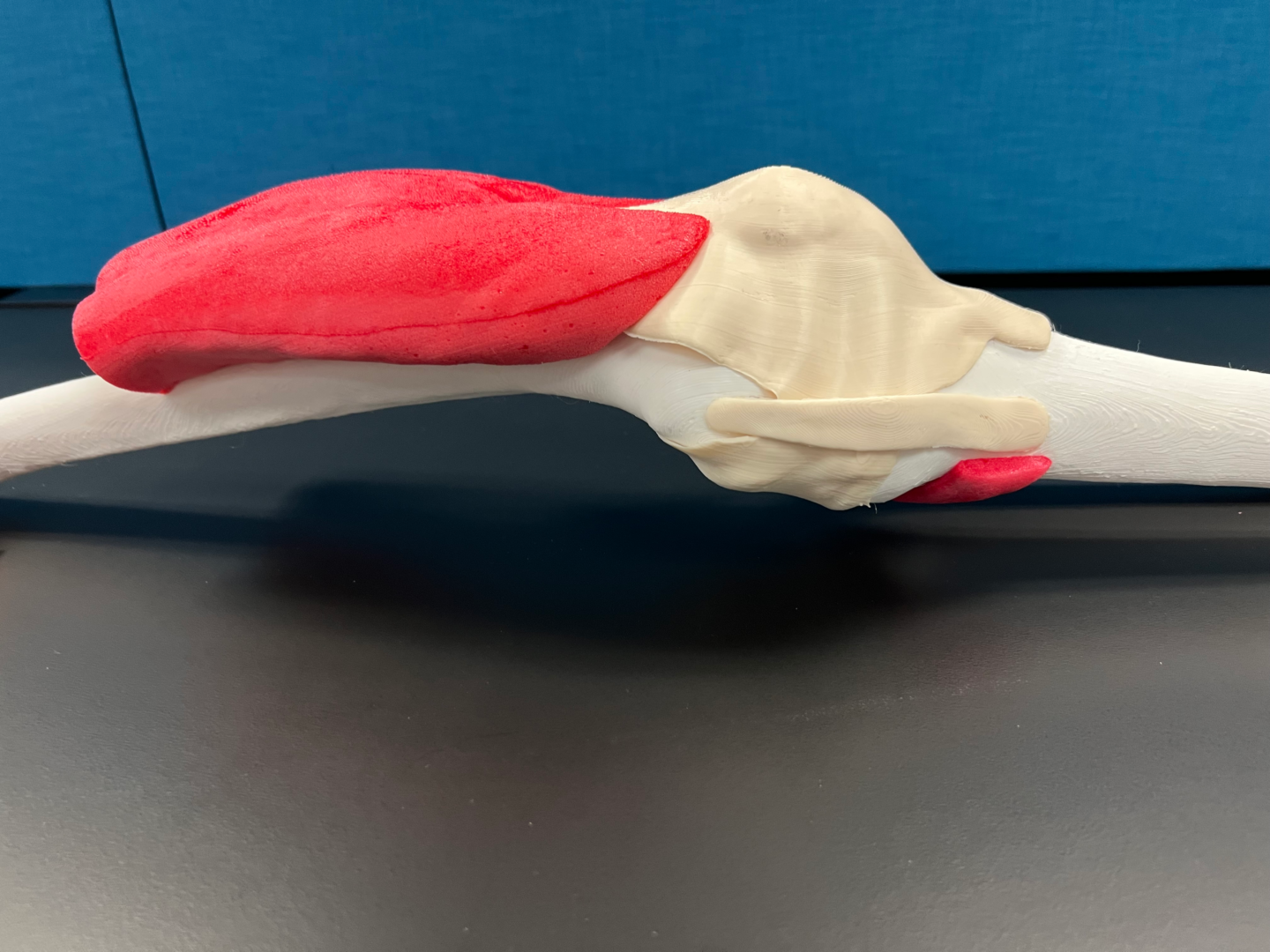 Comprehensive Knee – Casted – SurgiSTUD