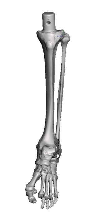 Ankle Base Model – SurgiSTUD