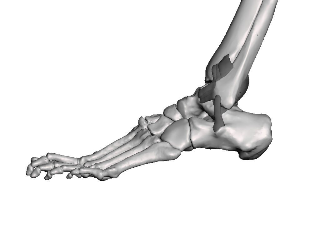 Ankle Base Model – SurgiSTUD