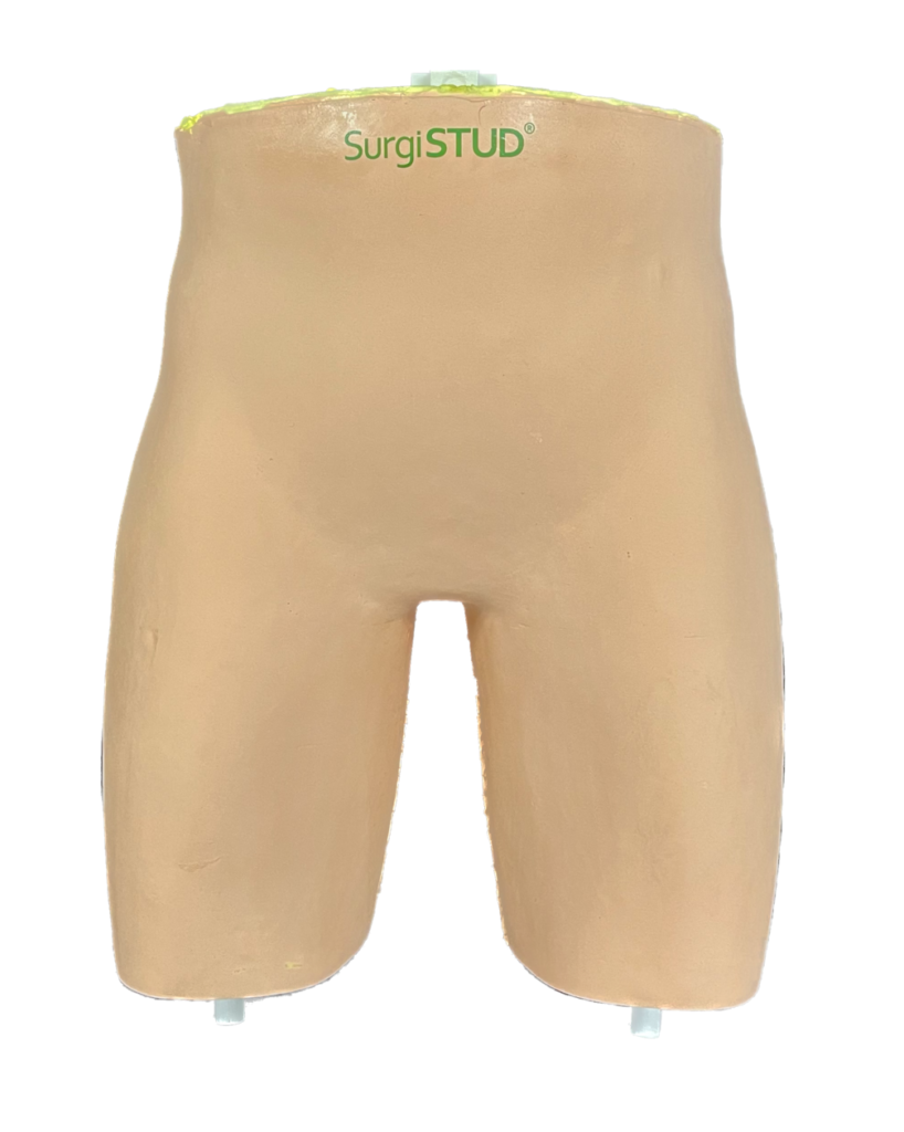 Comprehensive Bilateral Hip – Casted – SurgiSTUD